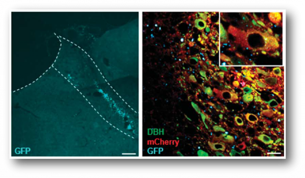 Nerve injury induces transient locus coeruleus activation over time ...